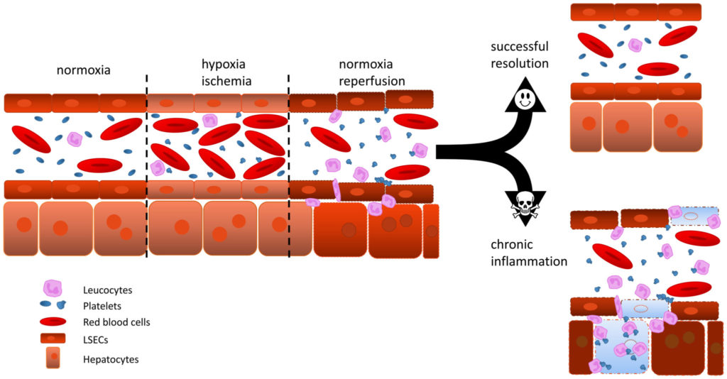 B08 - Platelets in resolution of liver inflammation and tissue ...